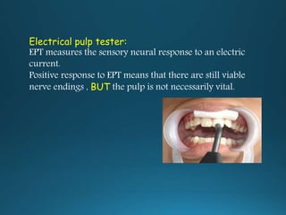Endodontic instruments 1 | PPTX