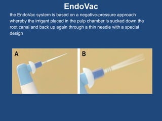 Endodontic irrigants pres | PPTX | First Aid | Injuries