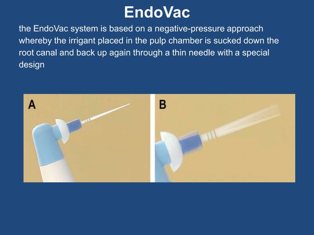 Endodontic irrigants pres | PPTX | First Aid | Injuries