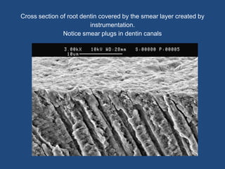 Endodontic irrigants pres | PPTX | First Aid | Injuries