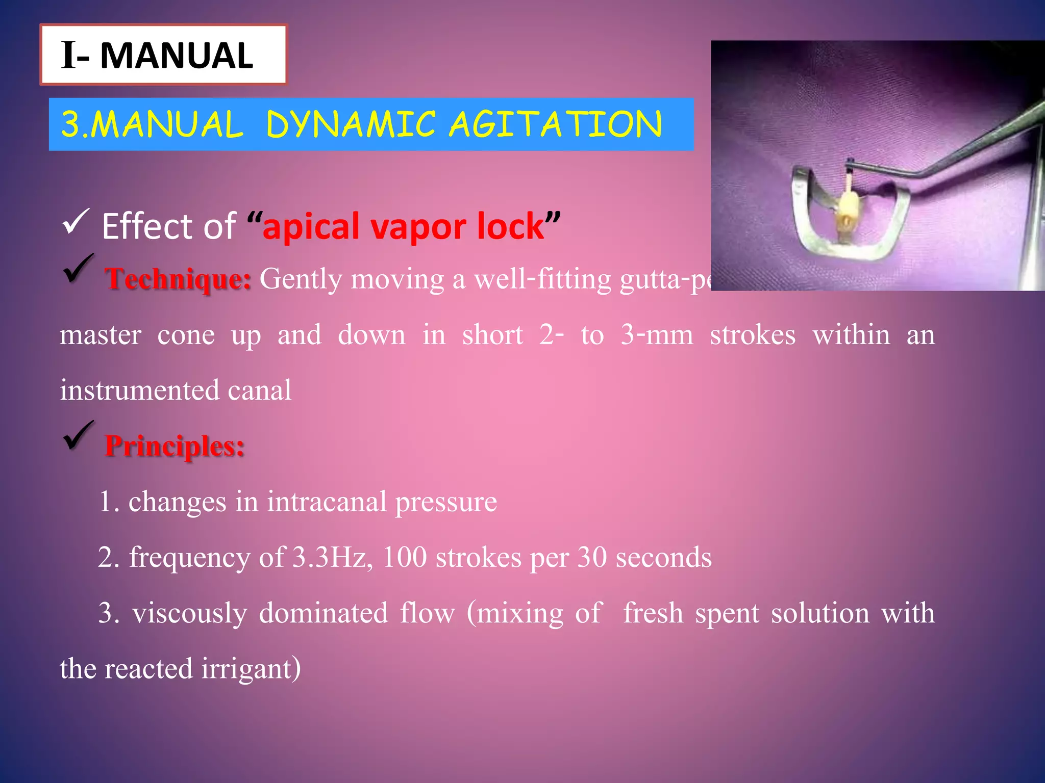 Endodontic irrigating devises | PPTX