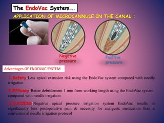Endodontic irrigating devises | PPTX