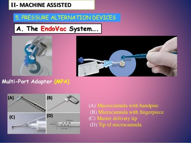 Endodontic irrigating devises