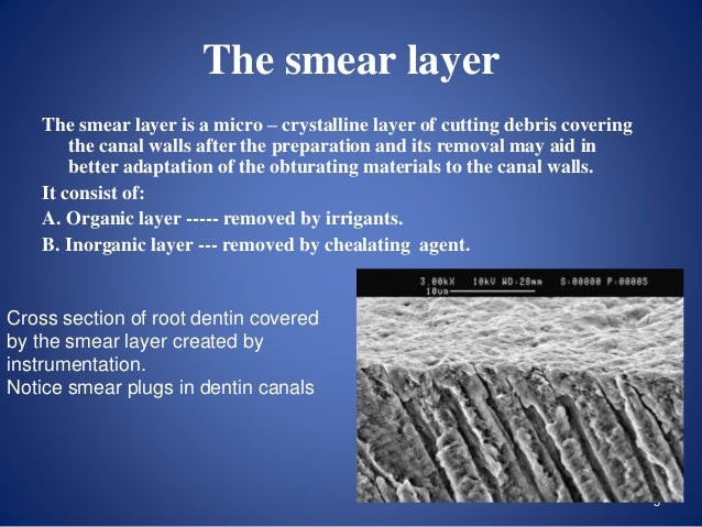 Endodontic irrigating solutions