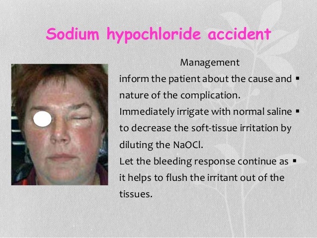 Endodontic irrigation