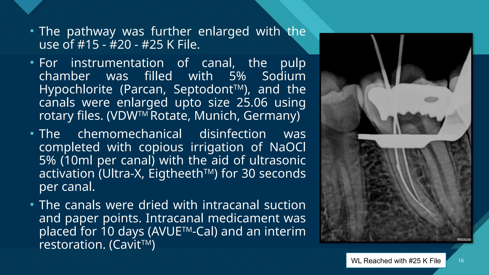 Endodontic Management of a Mandibular Molar with a.pptx