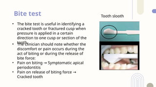 endodon management of cracked tooth.pptx
