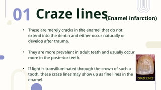 endodon management of cracked tooth.pptx