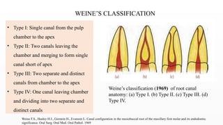ENDODONTIC MANAGEMENT OF VERTUCCI –TYPE IV MANDIBULAR.pptx