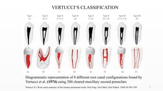 ENDODONTIC MANAGEMENT OF VERTUCCI –TYPE IV MANDIBULAR.pptx