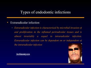 Endodontic microbiology | PPT