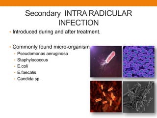 Endodontic microbiology | PPTX