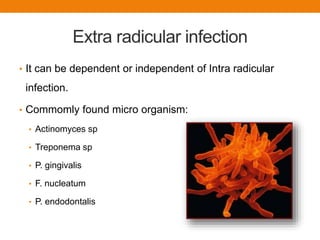 Endodontic microbiology | PPTX