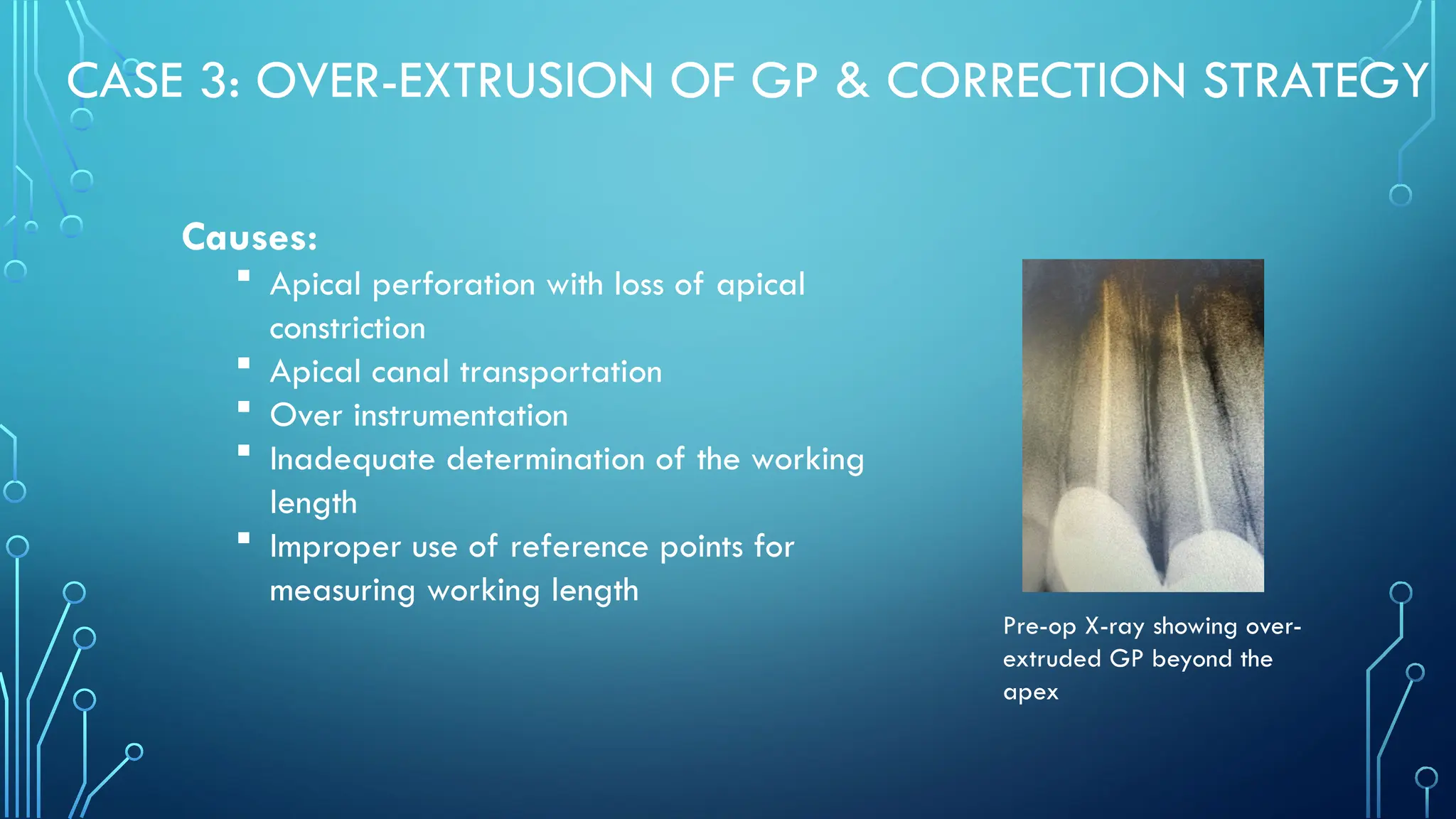 ENDODONTIC MISHAPS: NAVIGATING THE UNEXPECTED | PPTX
