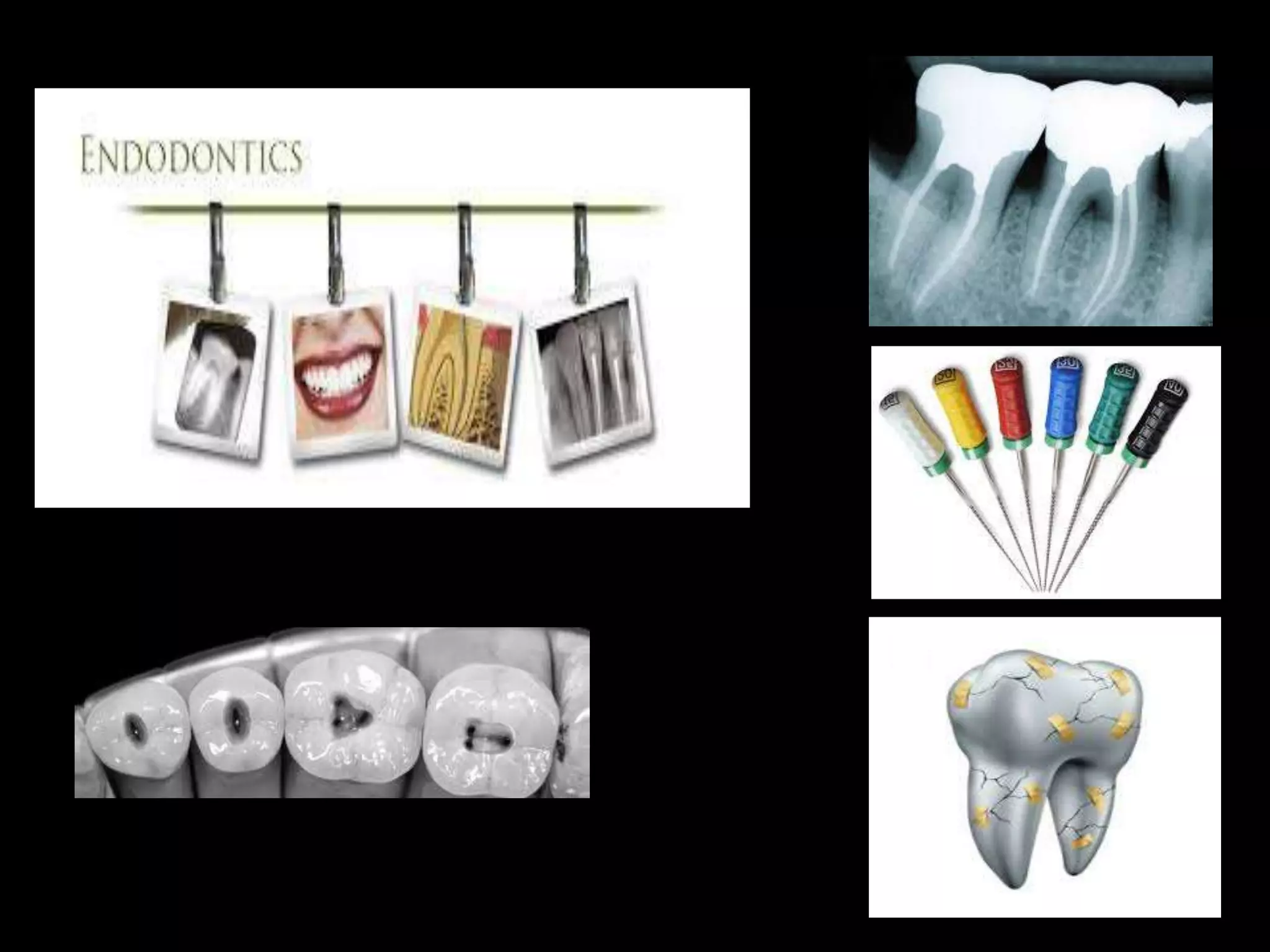 Endodontic mishaps/PROCEDURAL ACCIDENTS | PPTX