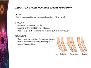 Endodontic mishaps/PROCEDURAL ACCIDENTS | PPTX