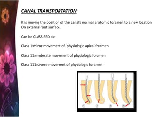 Endodontic mishaps/PROCEDURAL ACCIDENTS | PPTX