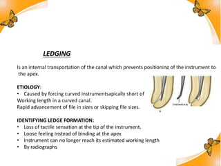Endodontic mishaps/PROCEDURAL ACCIDENTS | PPTX