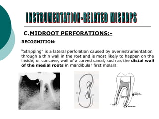 ENDODONTIC MISHAPS.ppt