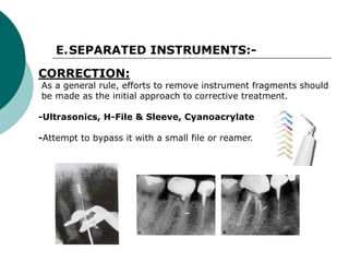 ENDODONTIC MISHAPS.ppt
