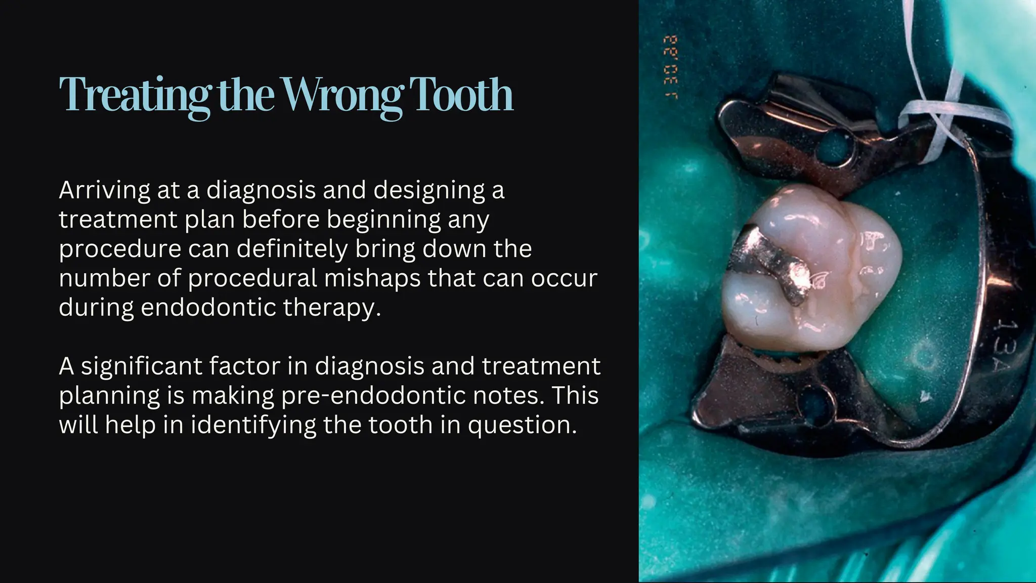 Endodontic Mishaps by Dr Abbas Ghintab .pdf