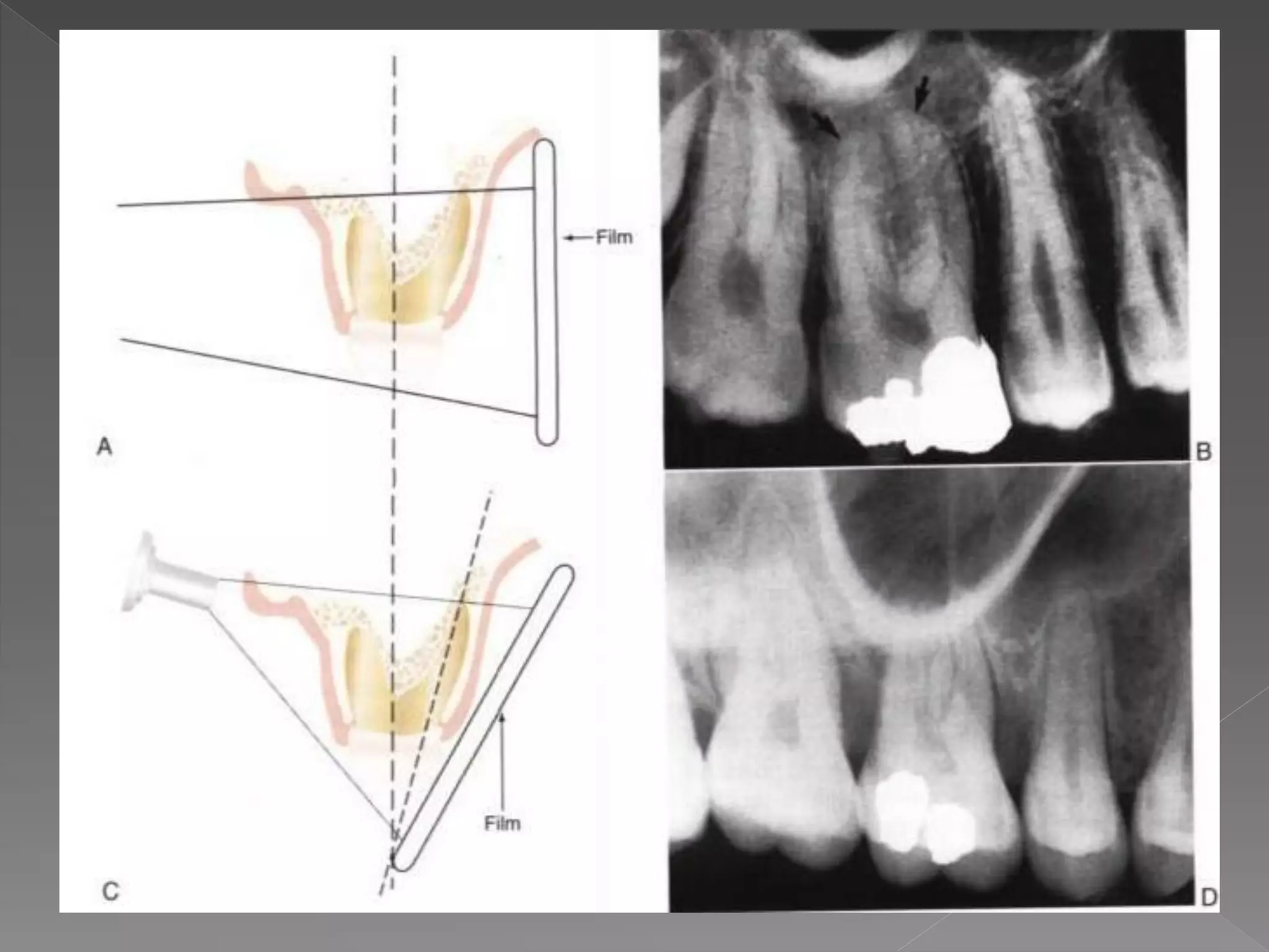 Endodontic radiograph | PPT