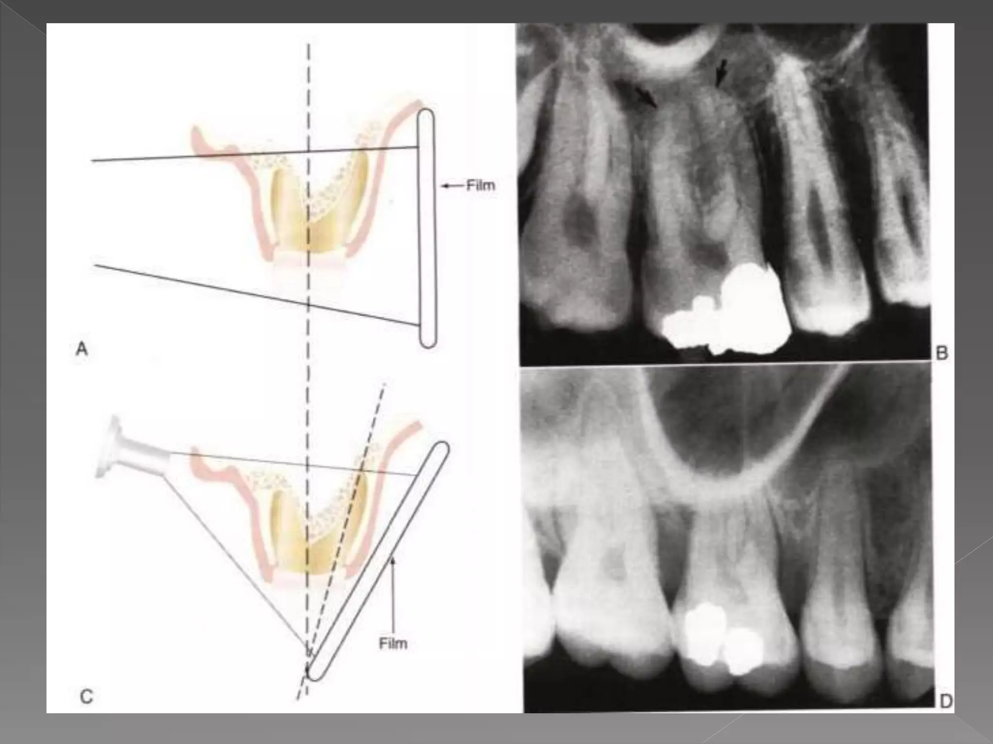 Endodontic radiograph | PPT