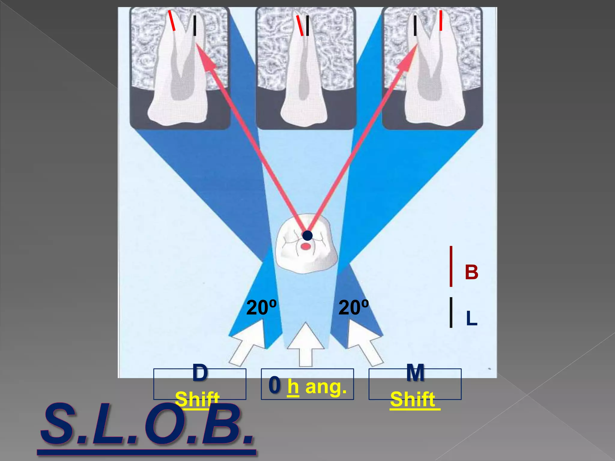 Endodontic radiograph | PPT
