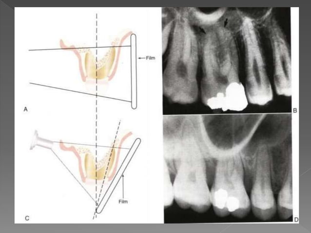 Endodontic radiograph | PPT