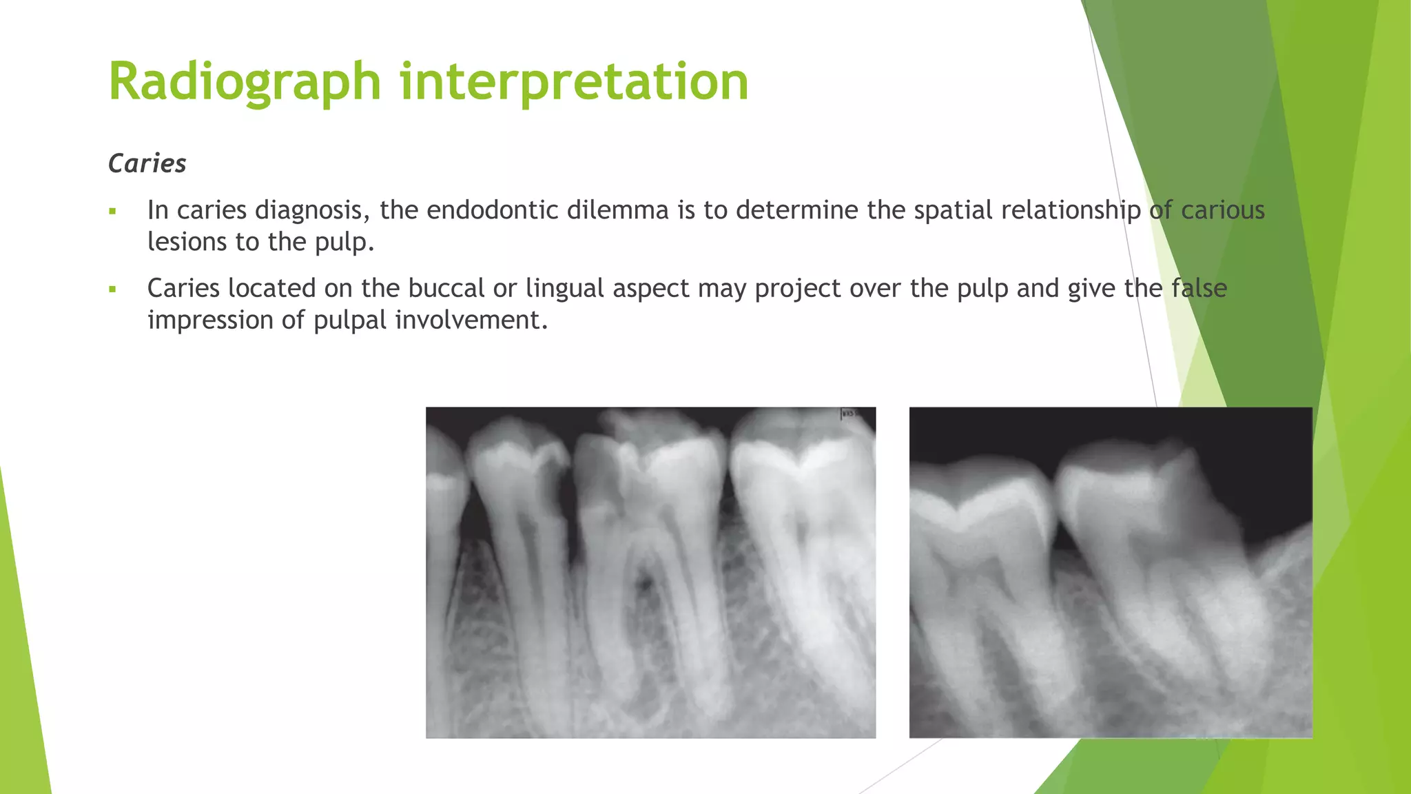 Endodontic radiography | PPTX