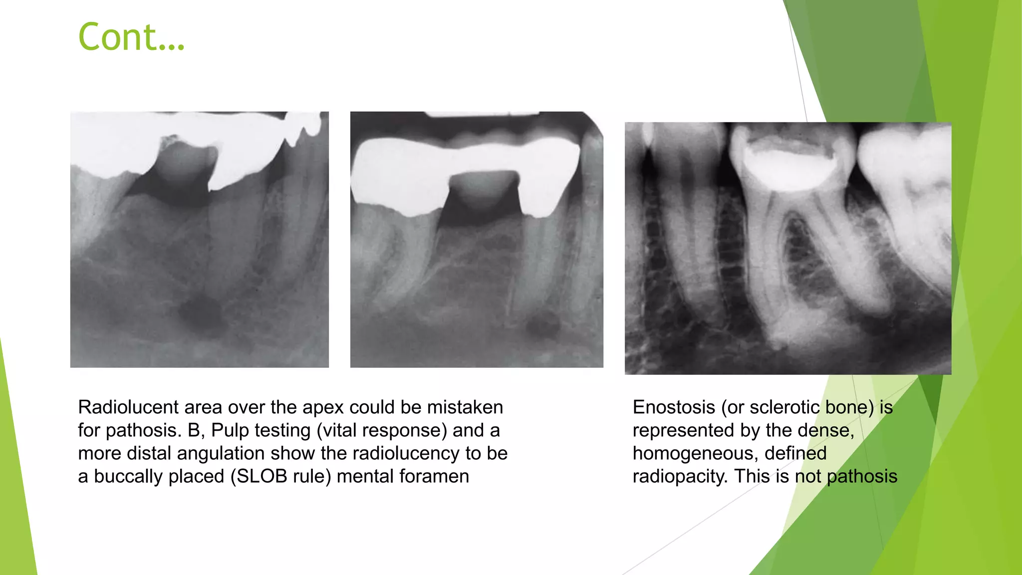 Endodontic radiography | PPTX