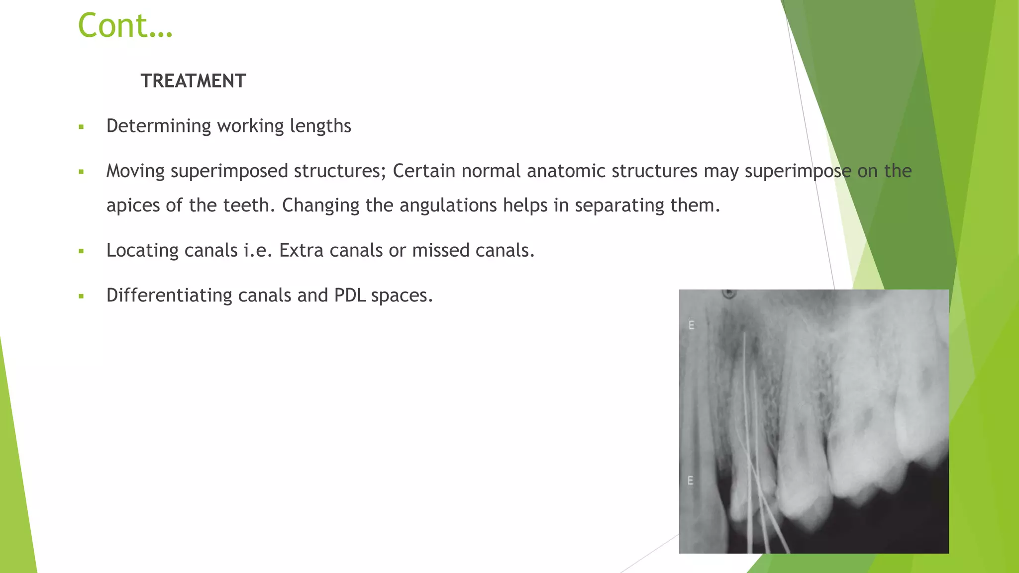 Endodontic radiography | PPTX