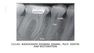 Endodontic Radiography | PPTX