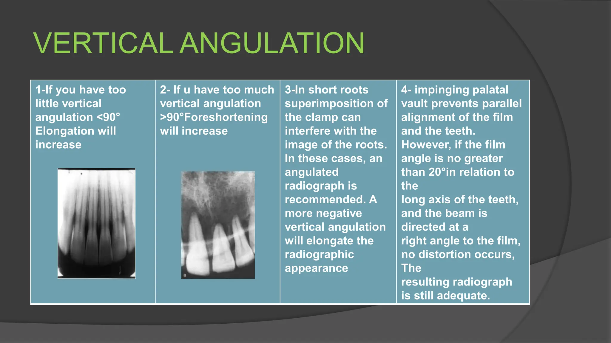 Endodontic radiography.................. | PPTX