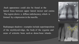 Endodontic radiography.................. | PPTX