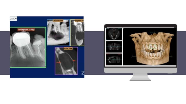 Endodontic radiography.................. | PPTX | Dental Health ...
