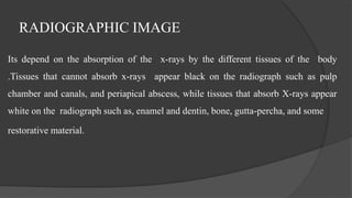 Endodontic radiography.................. | PPTX