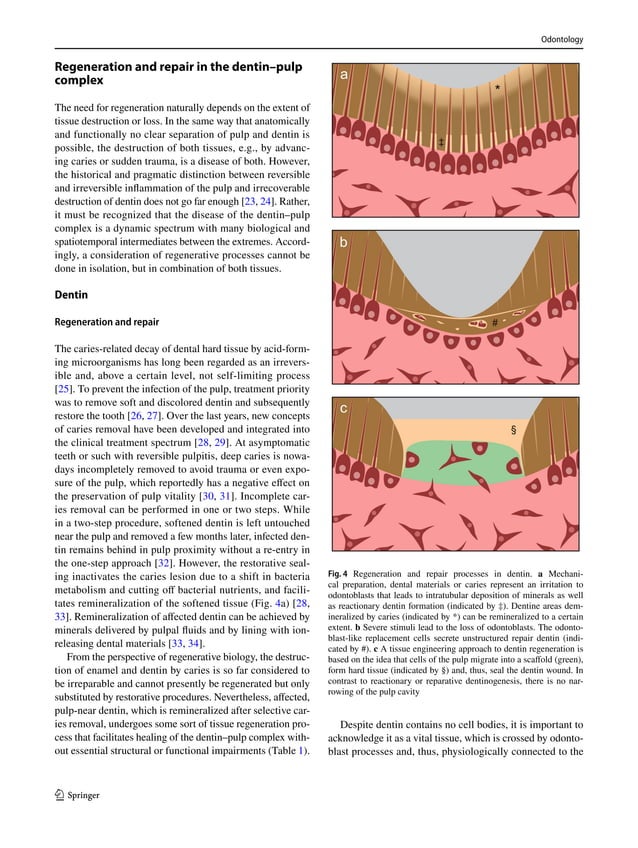 Endodontic_regeneration_hard_shell_soft_core.pdf | Dental Health ...