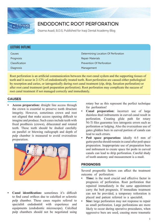 Endodontic Root Perforation: Causes, Identification, and Management ...