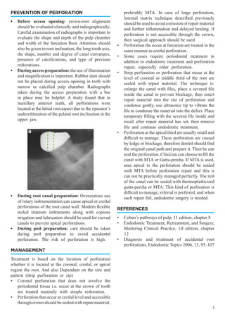 Endodontic Root Perforation: Causes, Identification, and Management ...
