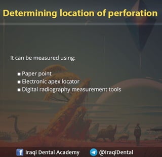 Endodontic Root Perforation: Causes, Identification, and Management ...
