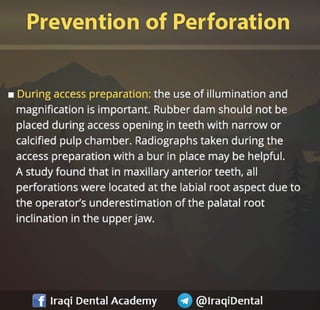 Endodontic Root Perforation: Causes, Identification, and Management ...