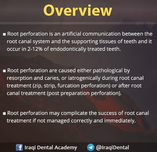 Endodontic Root Perforation: Causes, Identification, and Management ...