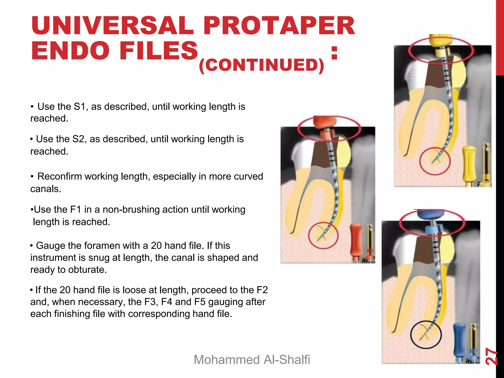 Endodontic rotary instruments in dental clinic | PPTX