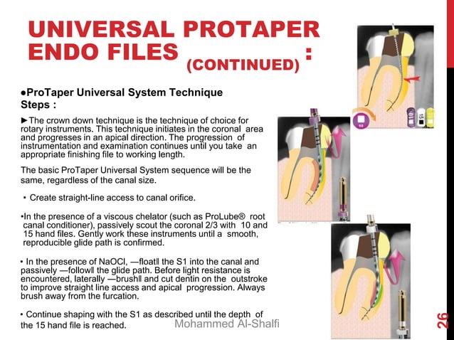 Endodontic rotary instruments in dental clinic | PPTX