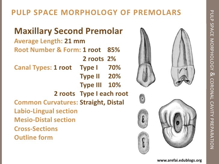 Maxillary First Premolar Canals