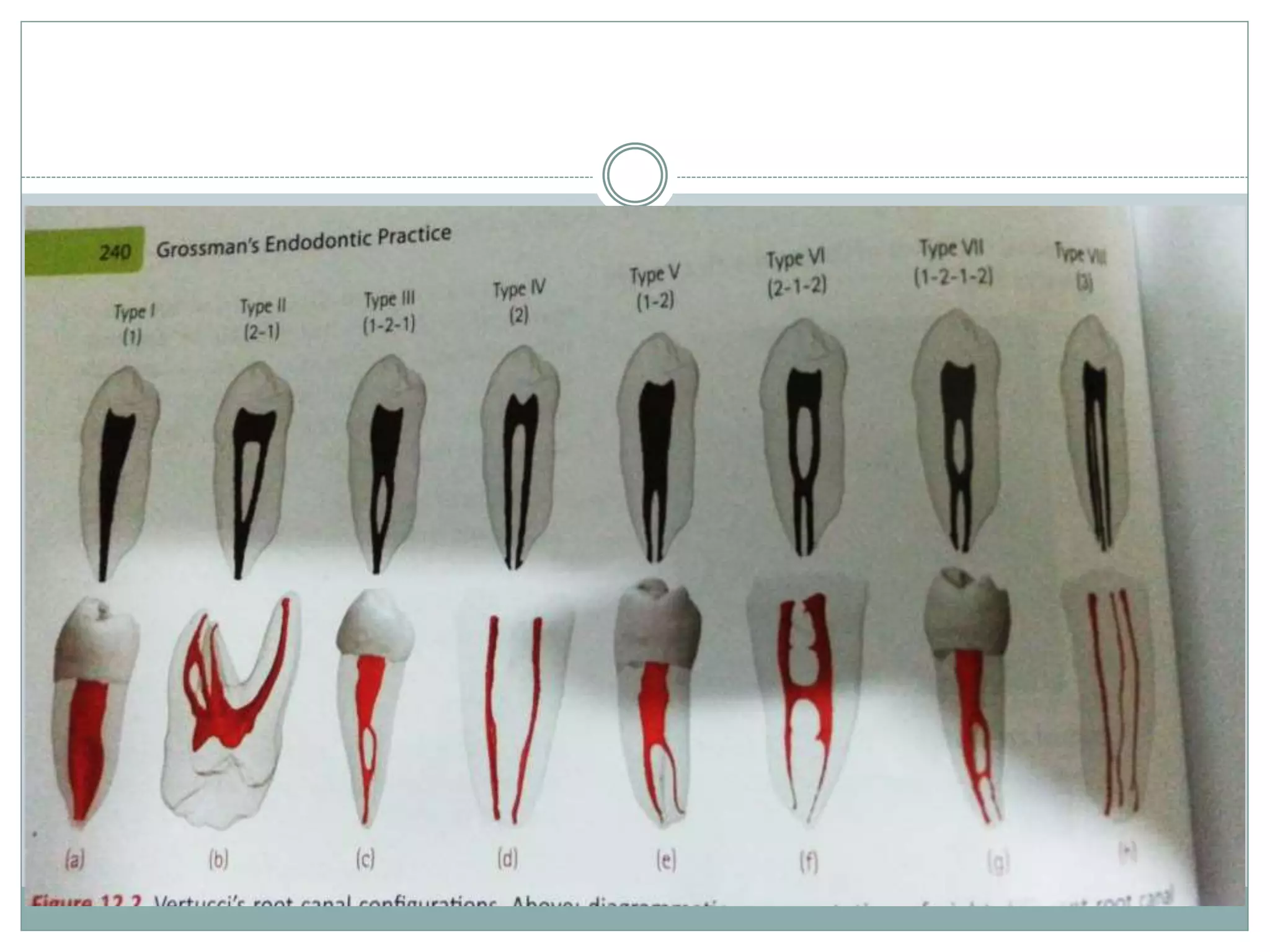 Anatomy of pulp chamber | PPTX