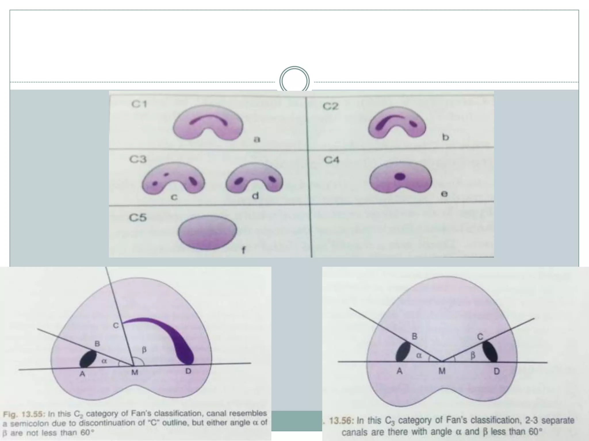 Anatomy of pulp chamber | PPTX