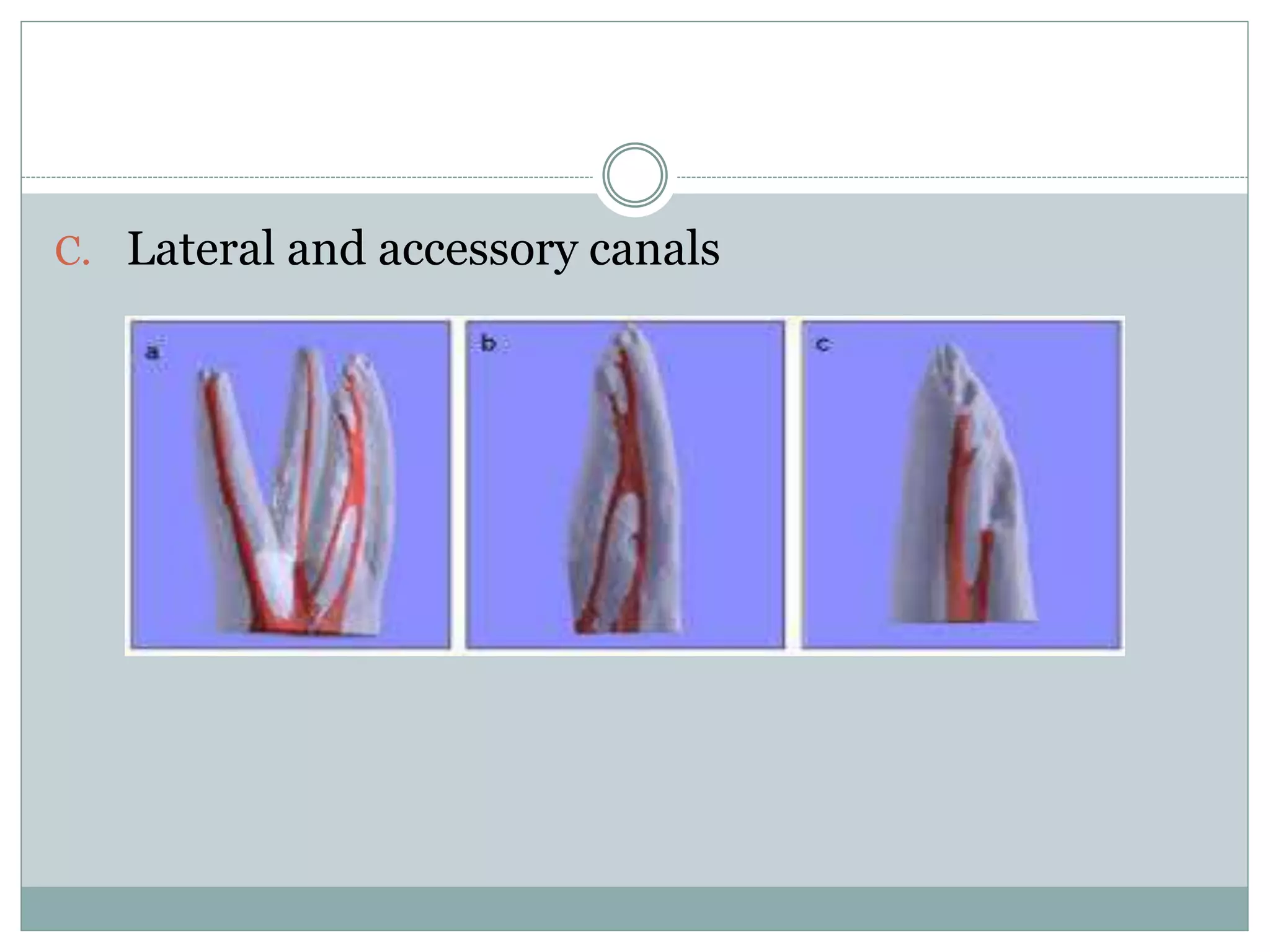 Anatomy of pulp chamber | PPTX