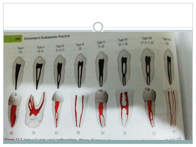 Anatomy of pulp chamber | PPTX | Dental Health | Diseases and Conditions